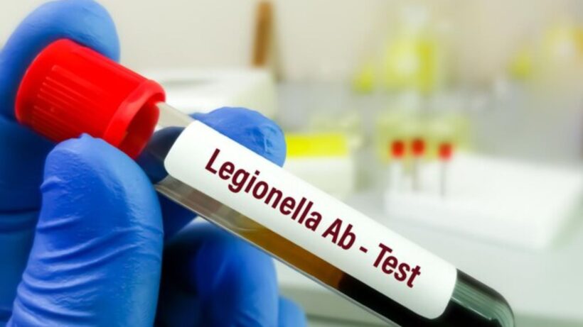 What You Need to Know About Legionella Testing in UAE: Expert Advice